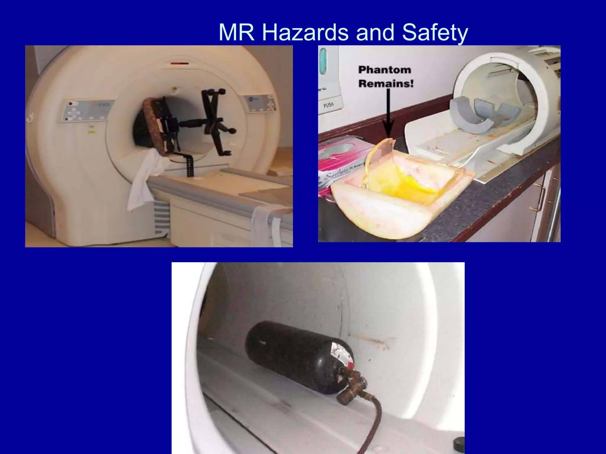 Mri hazards & safety Daniel JP | PPTX
