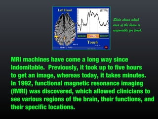 MRI | PPT