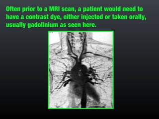 MRI | PPT