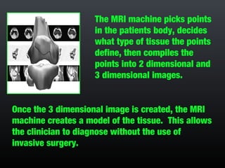 MRI | PPT