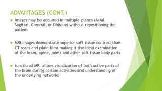 Magnetic Resonance Imaging - MRI | PPTX