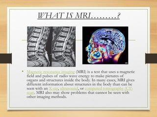 MRI | PPT