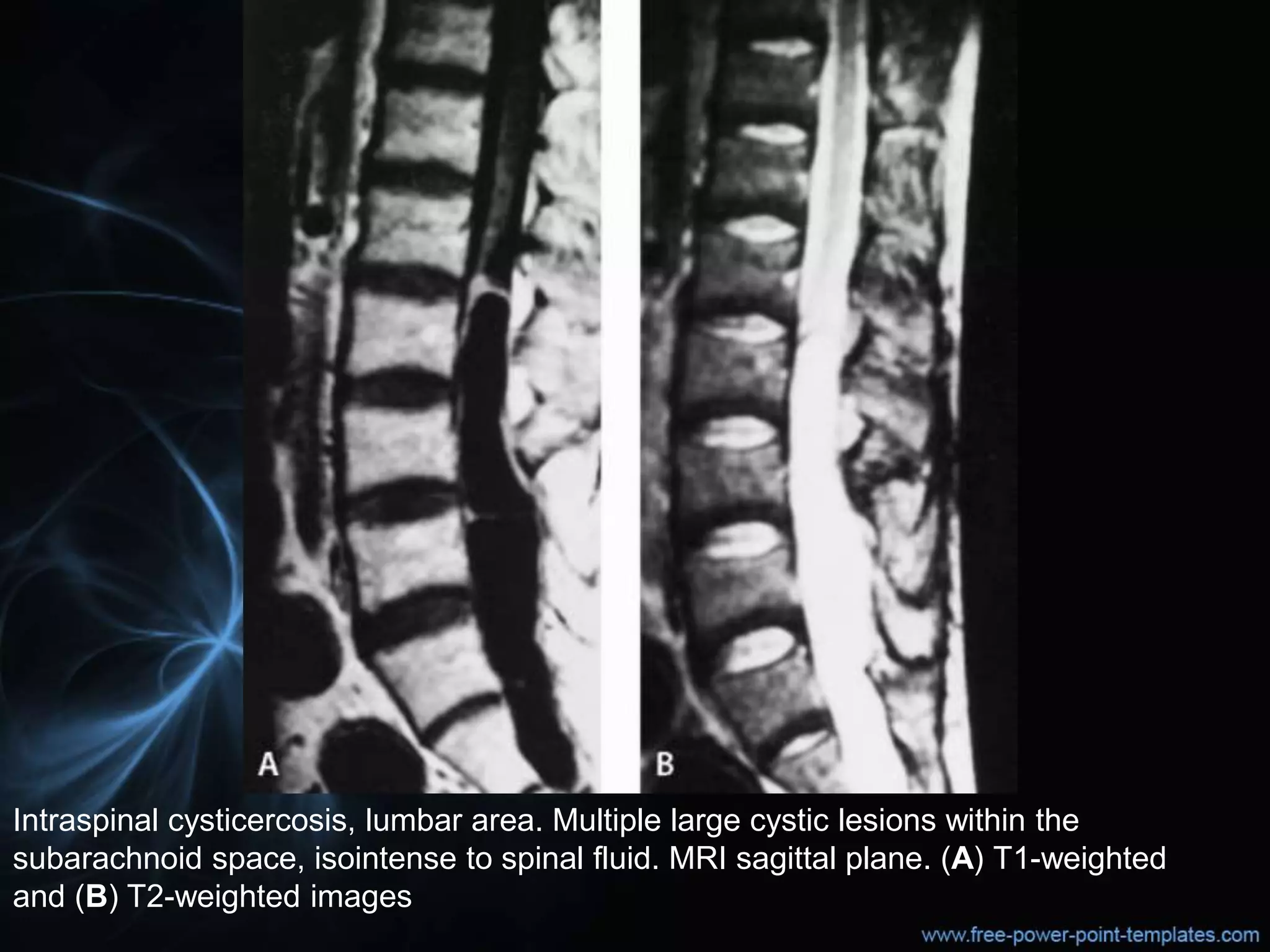 MRI (Magnetic resonance imaging) | PPTX