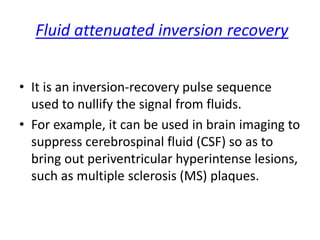 MRI Brain | PPTX