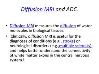 MRI Brain | PPTX