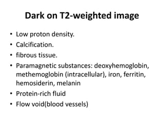 MRI Brain | PPTX