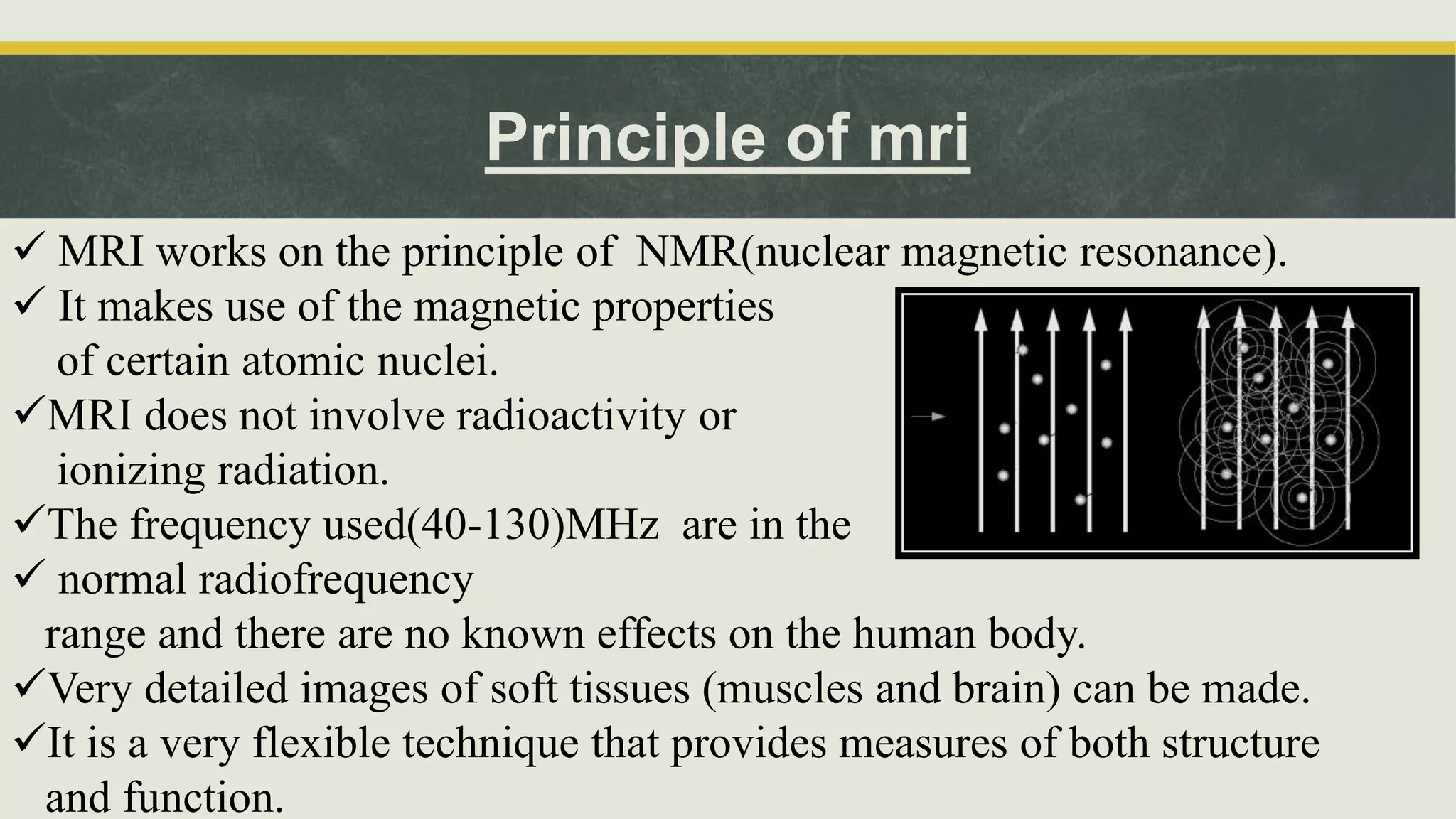 MRI | PPTX