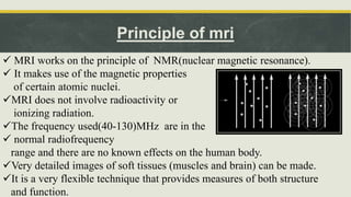 MRI | PPTX