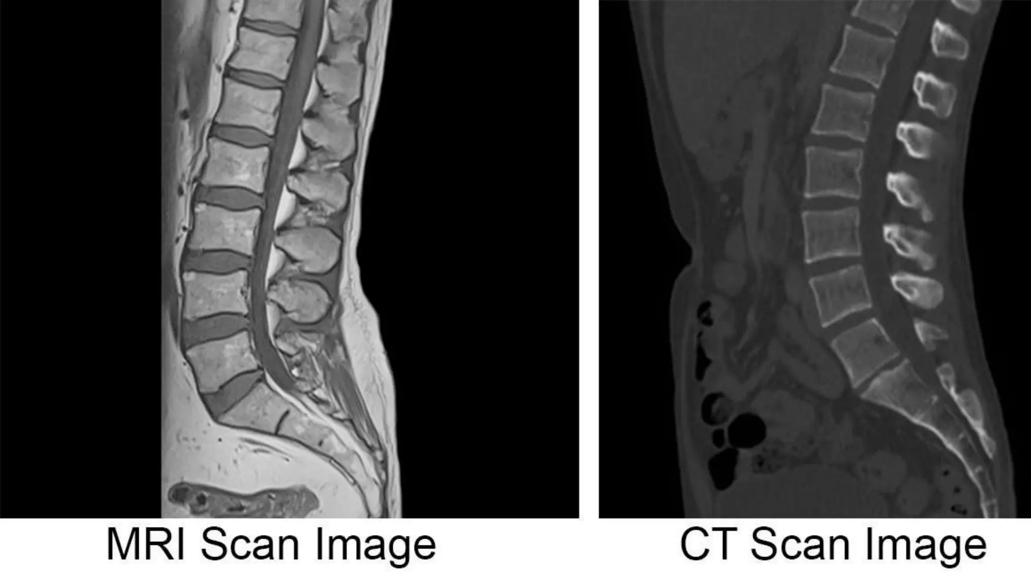 Mri | PPTX | Medical Tests | Medical Health