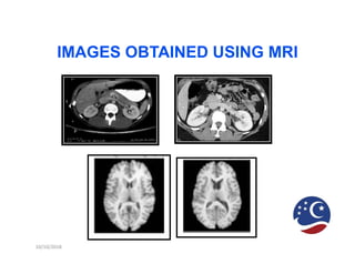 MRI.pdf