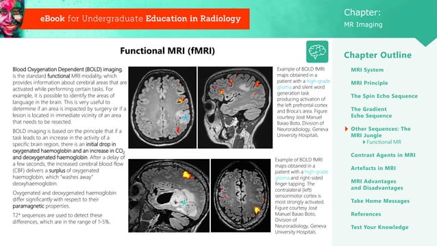 MRI and basic imaging of mri zzzzzxxxxxxxxxx | PPT
