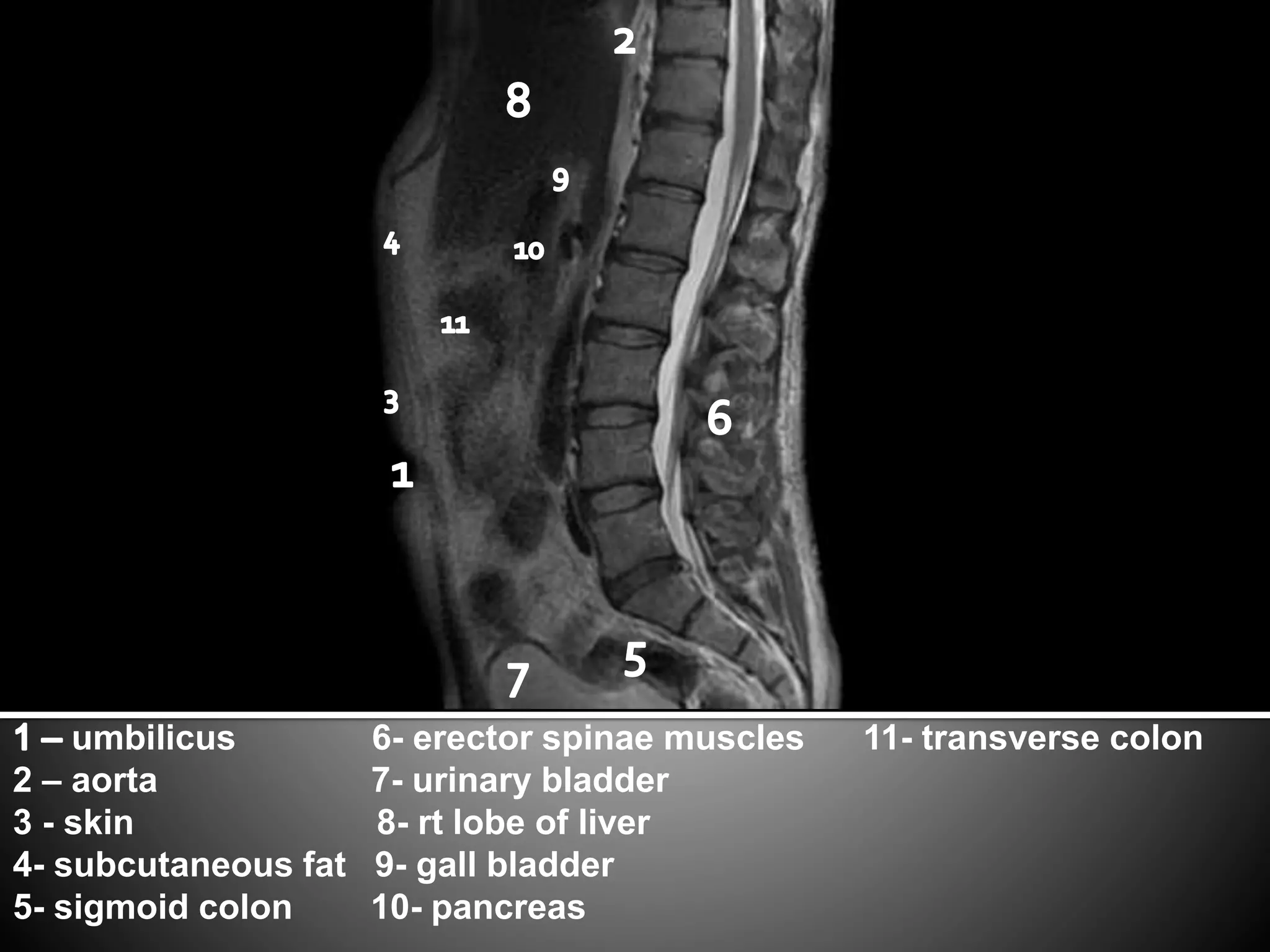 Mri abdomen sagittal | PPTX