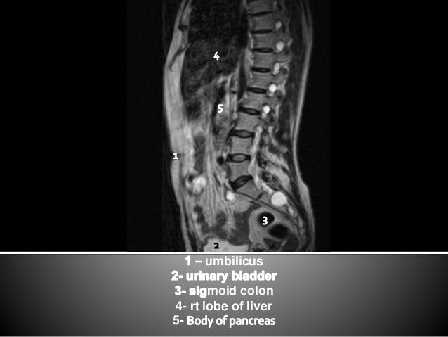 Mri abdomen sagittal