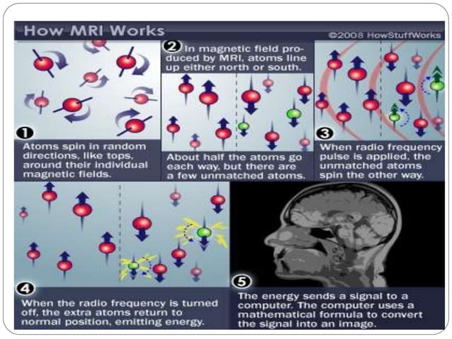 Mri basic principle and sequences