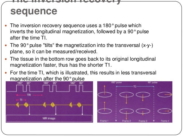 Mri basic principle and sequences