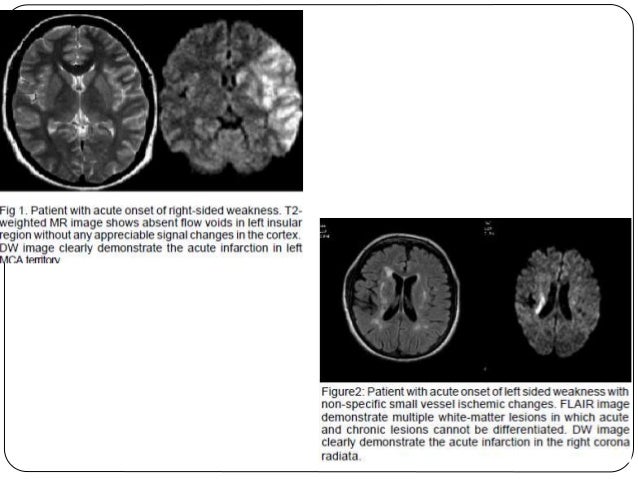 Mri basic principle and sequences