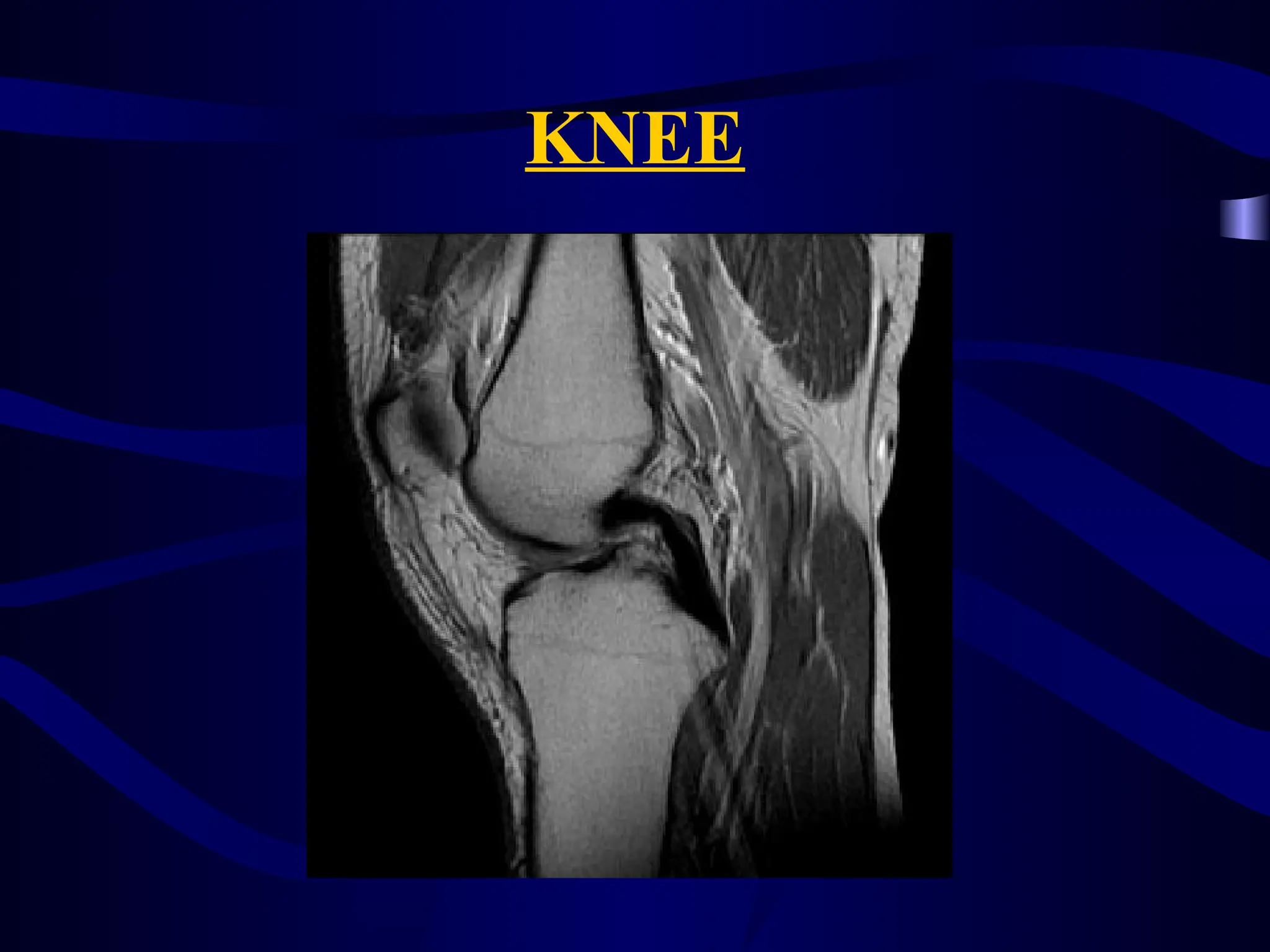 mri-for-beginners powerpoint presentation | PPT