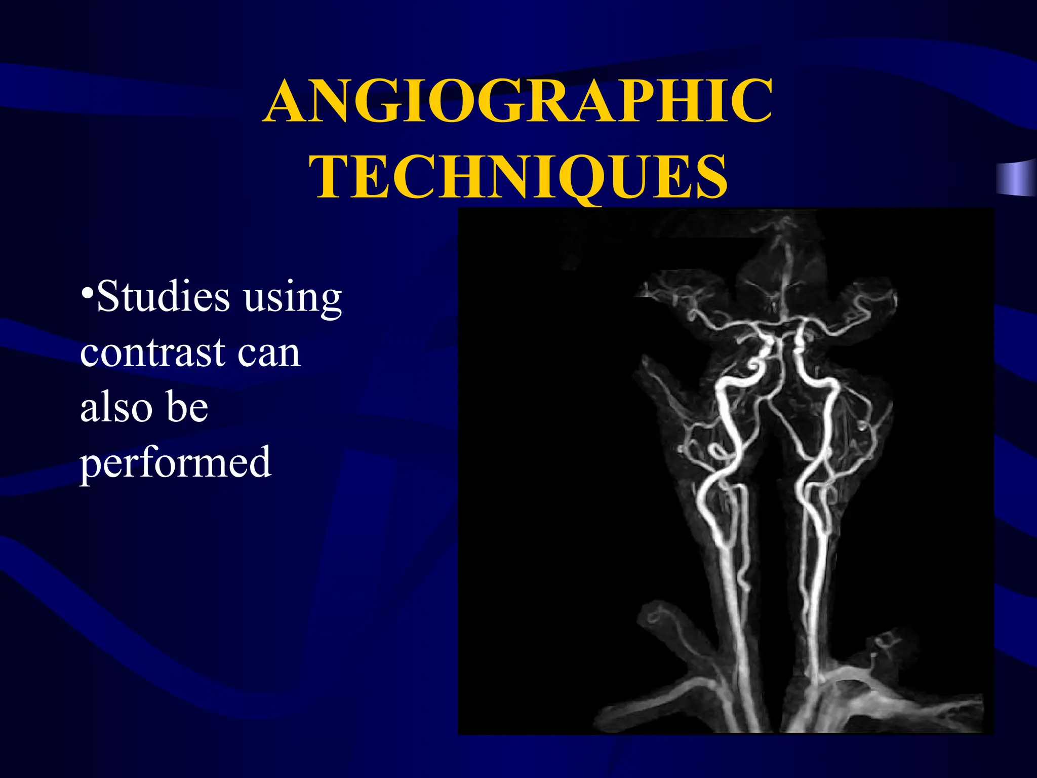 mri-for-beginners powerpoint presentation | PPT