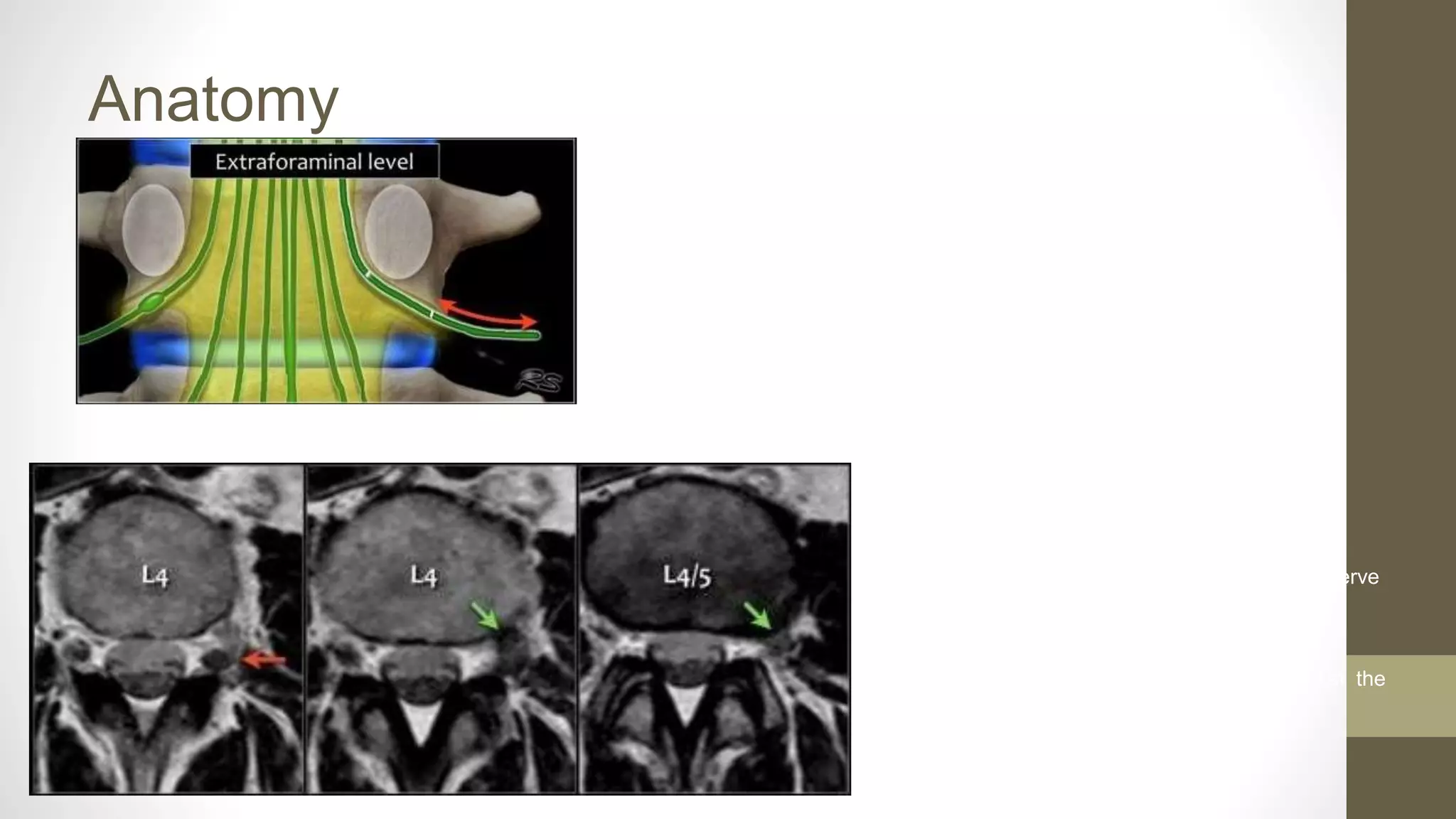 MRI-in Spine PPT.pptx