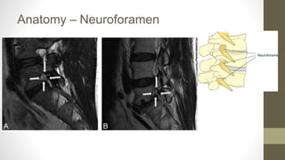 MRI-in Spine PPT.pptx