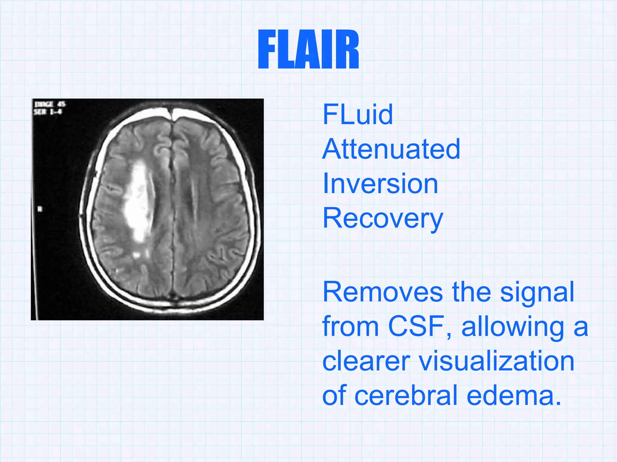 MRI Modalities | PPT | Medical Tests | Medical Health