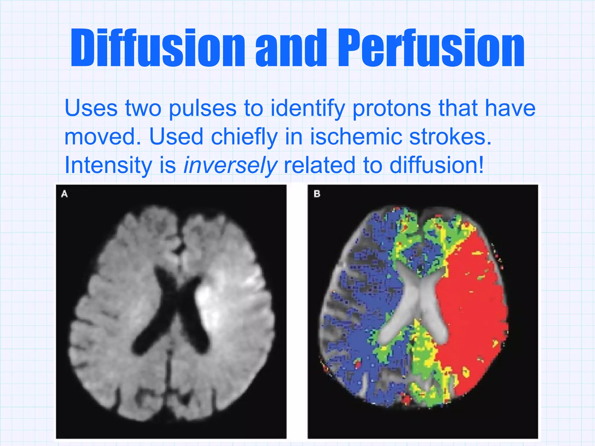 MRI Modalities | PPT | Medical Tests | Medical Health