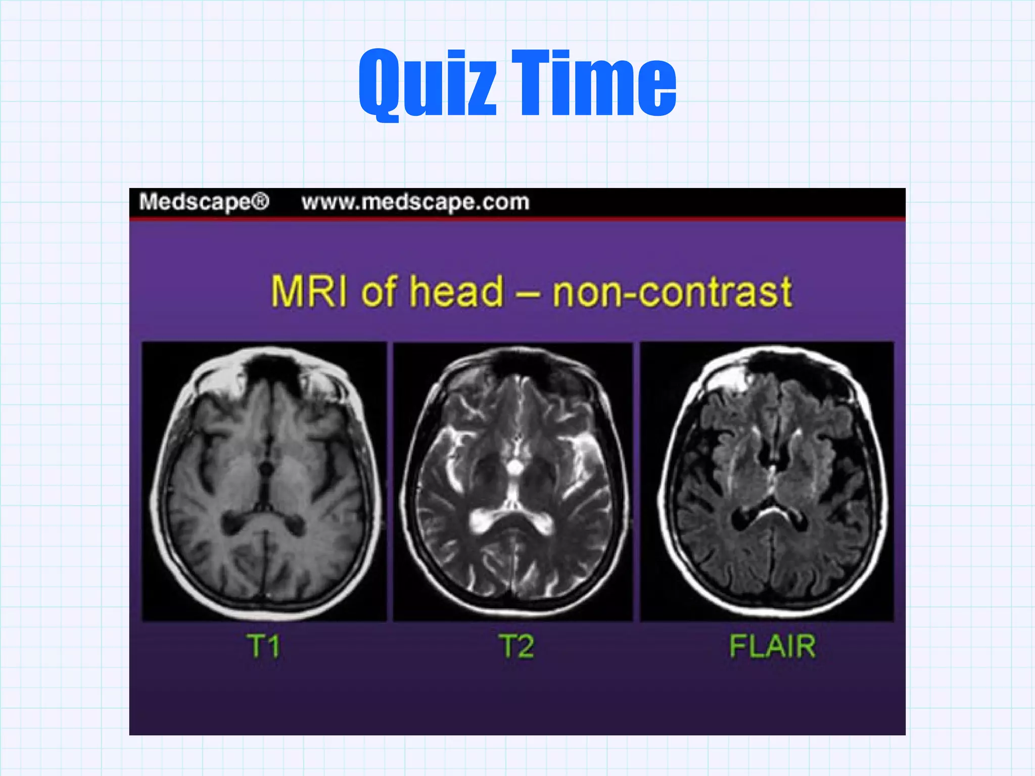 MRI Modalities | PPT | Medical Tests | Medical Health