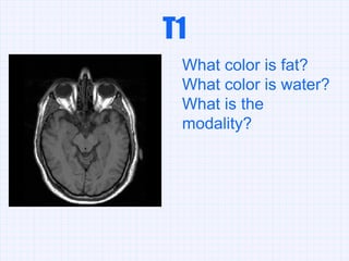 MRI Modalities | PPT | Medical Tests | Medical Health