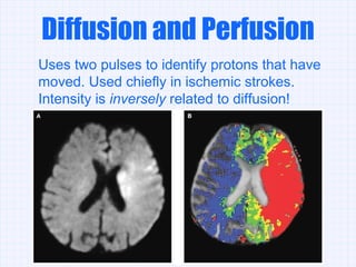 MRI Modalities | PPT | Medical Tests | Medical Health