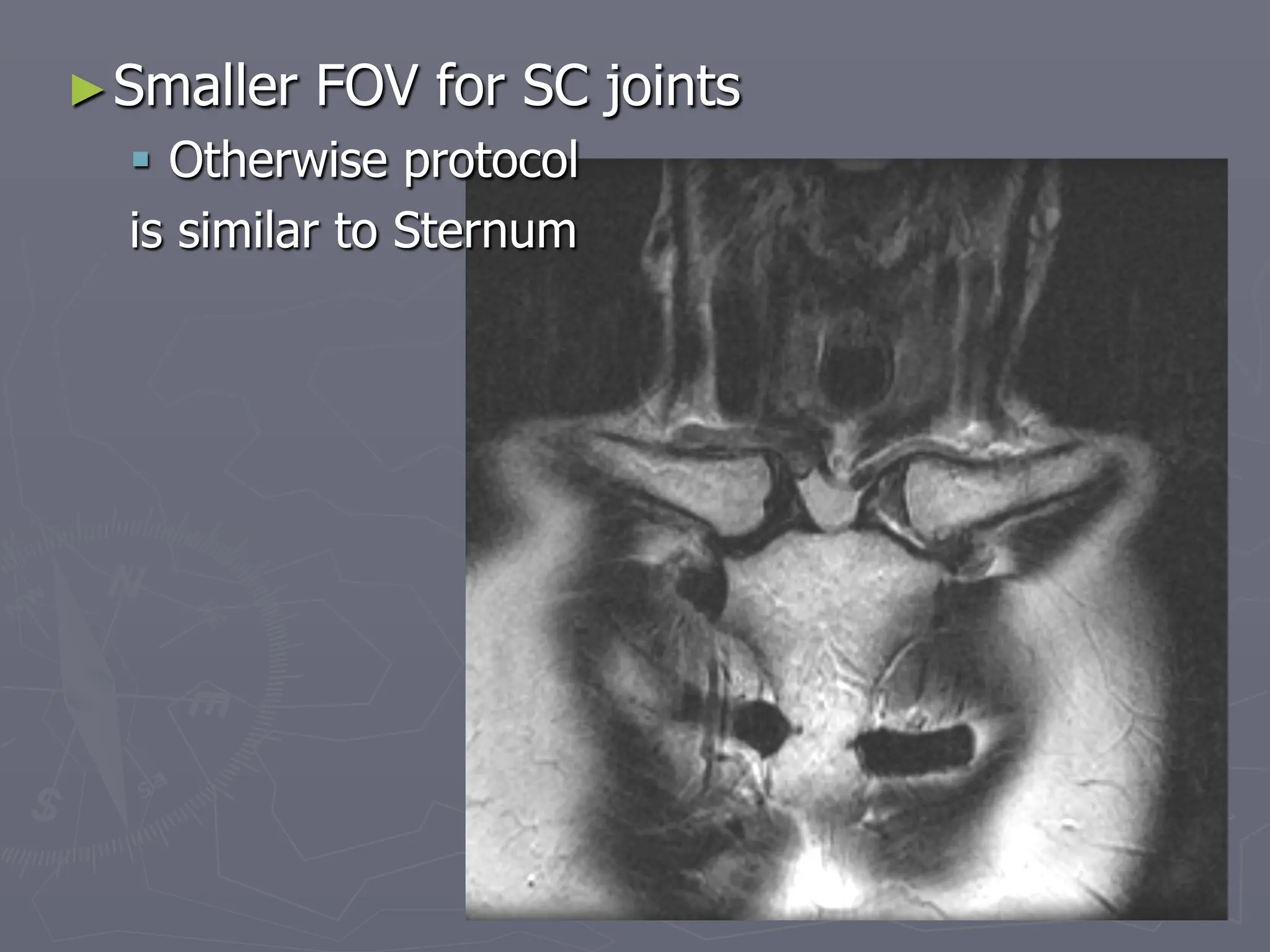 MRI protocol complete may 2016 musculoskeletal | PDF