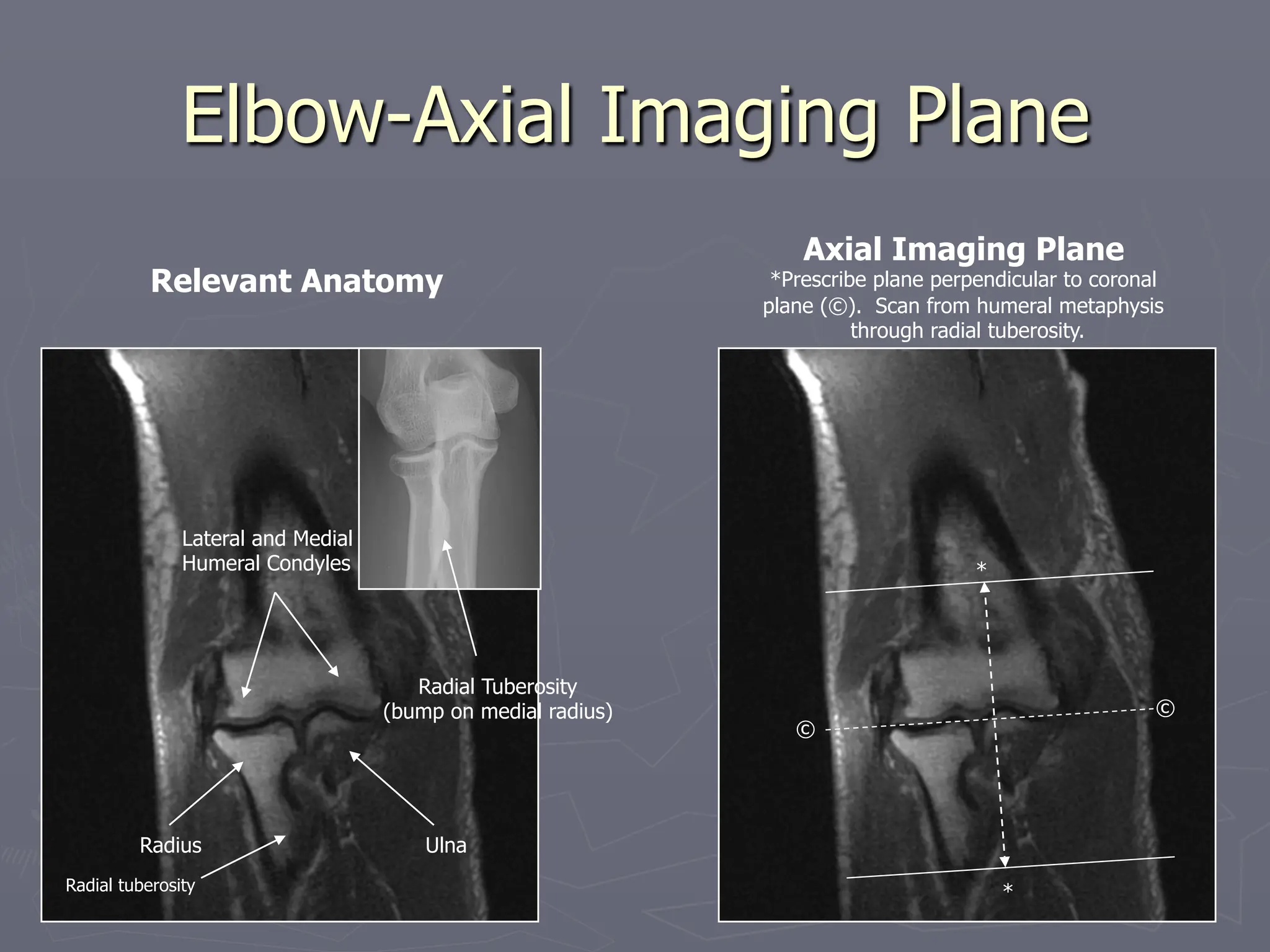 MRI protocol complete may 2016 musculoskeletal | PDF