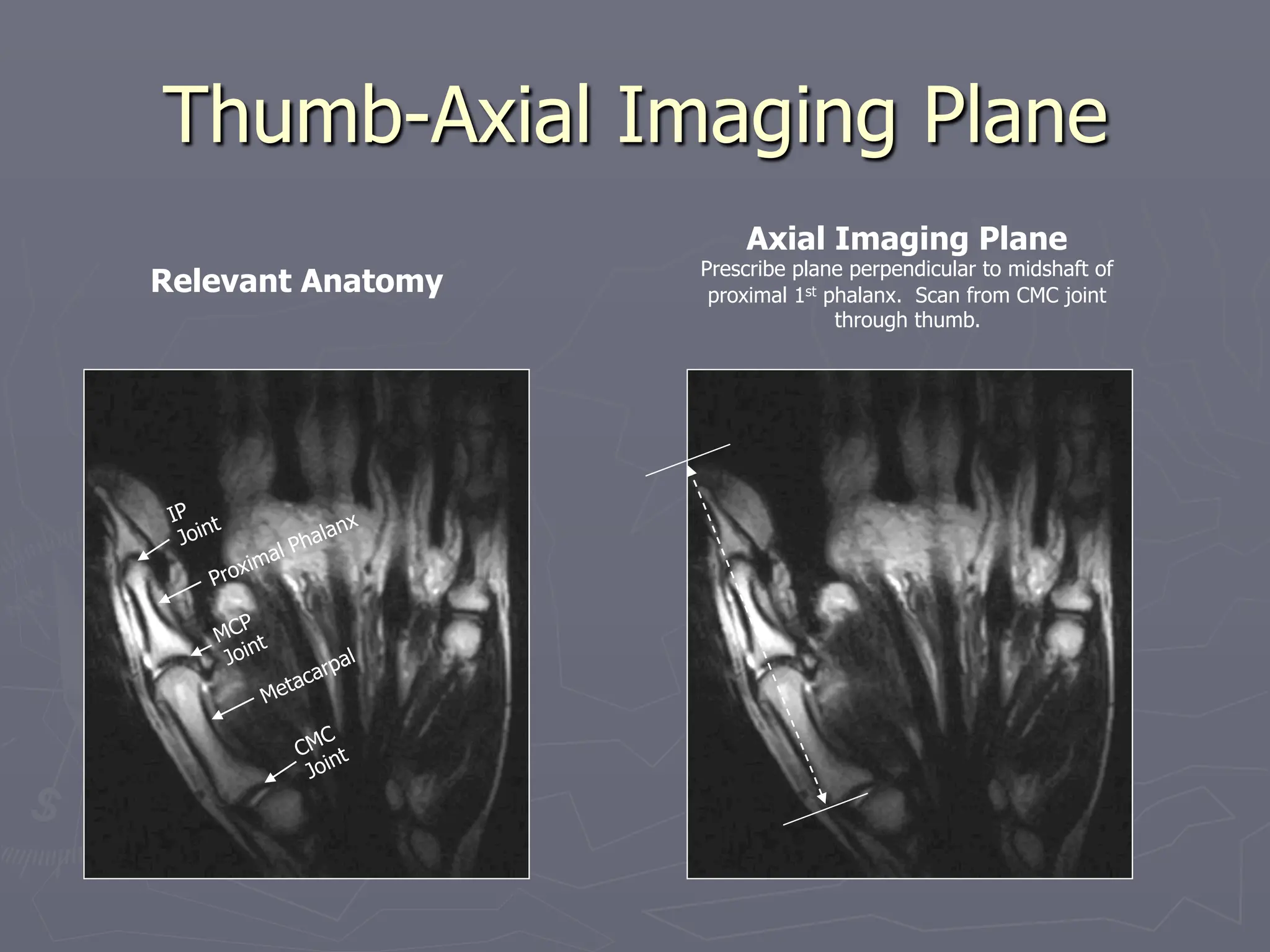 MRI protocol complete may 2016 musculoskeletal | PDF