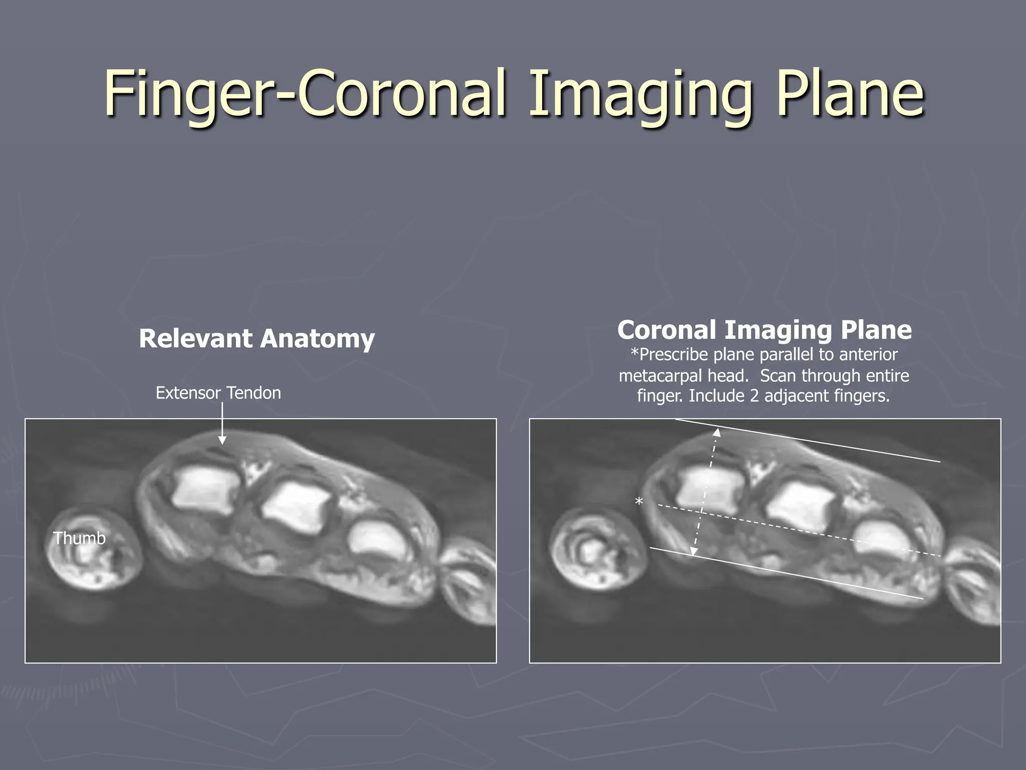MRI protocol complete may 2016 musculoskeletal | PDF