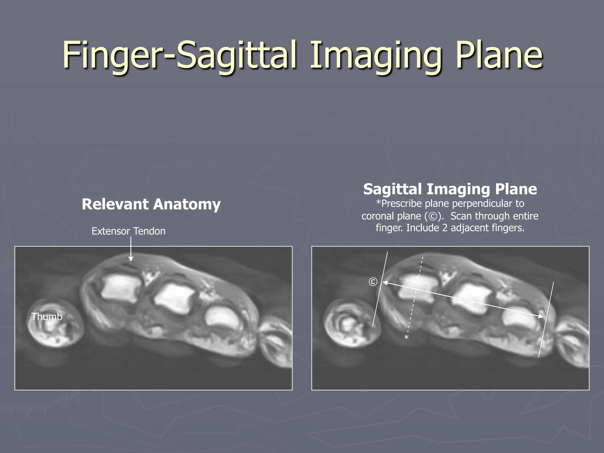 MRI protocol complete may 2016 musculoskeletal | PDF