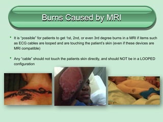 MRI-Safety-Powerpoint-Updated-5-24-21.pptx
