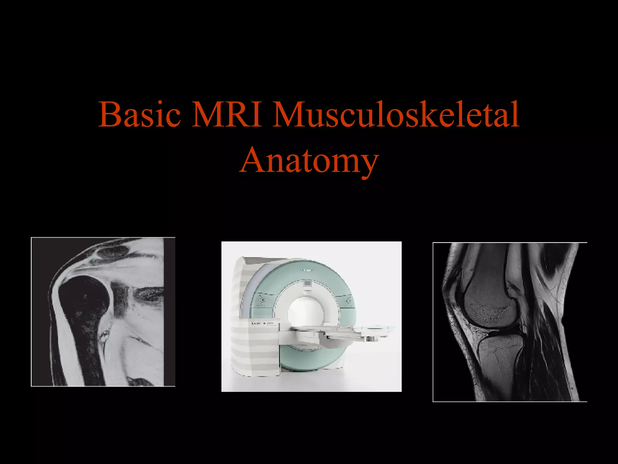 MRI slides, second yr students 2008 | PPT