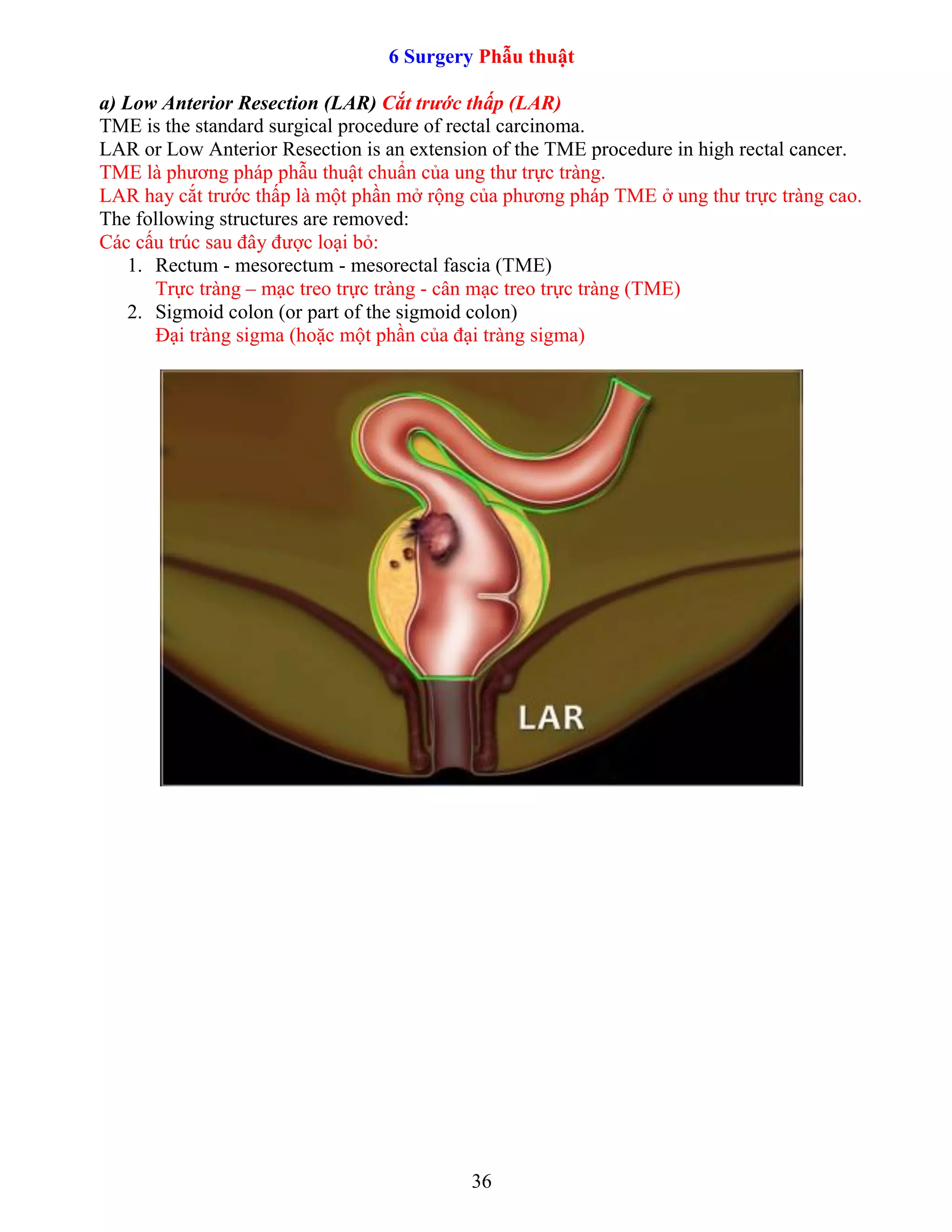 Đánh giá ung thư trực tràng trên MRI | PDF