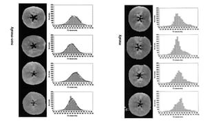 MAGNETIC RESONANCE IMAGING IN FOOD | PPTX