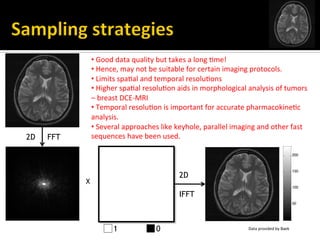 MRI: A historical perspective | PPT