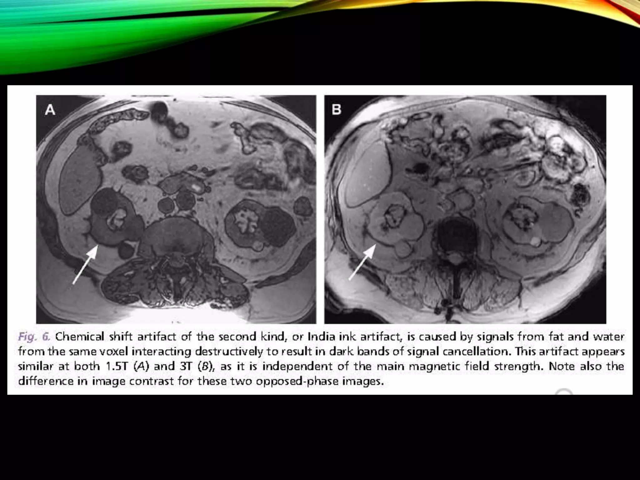 Physics of 3 Tesla MRI & Silent MRI | PPTX