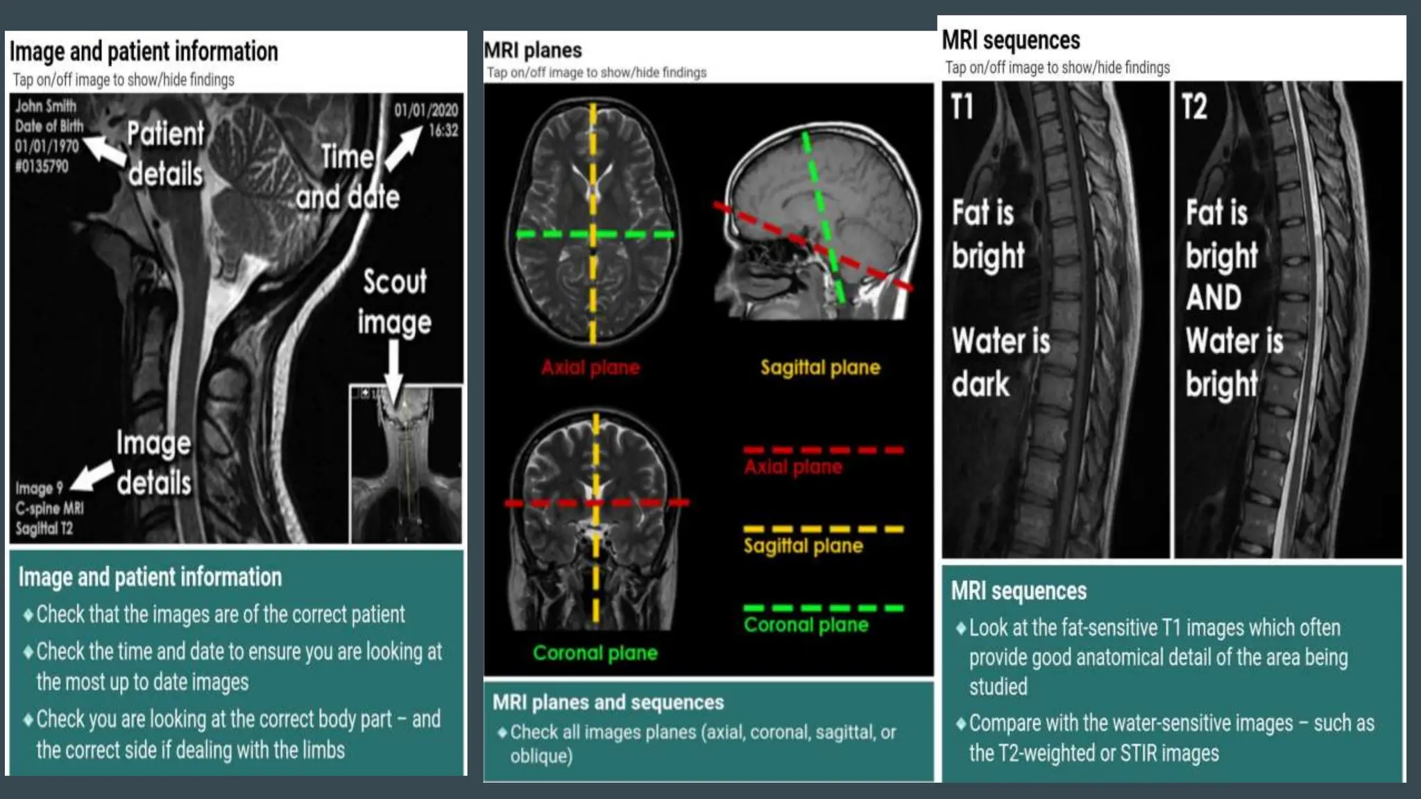 mri in orthopaedics its importance and understanding | PPTX