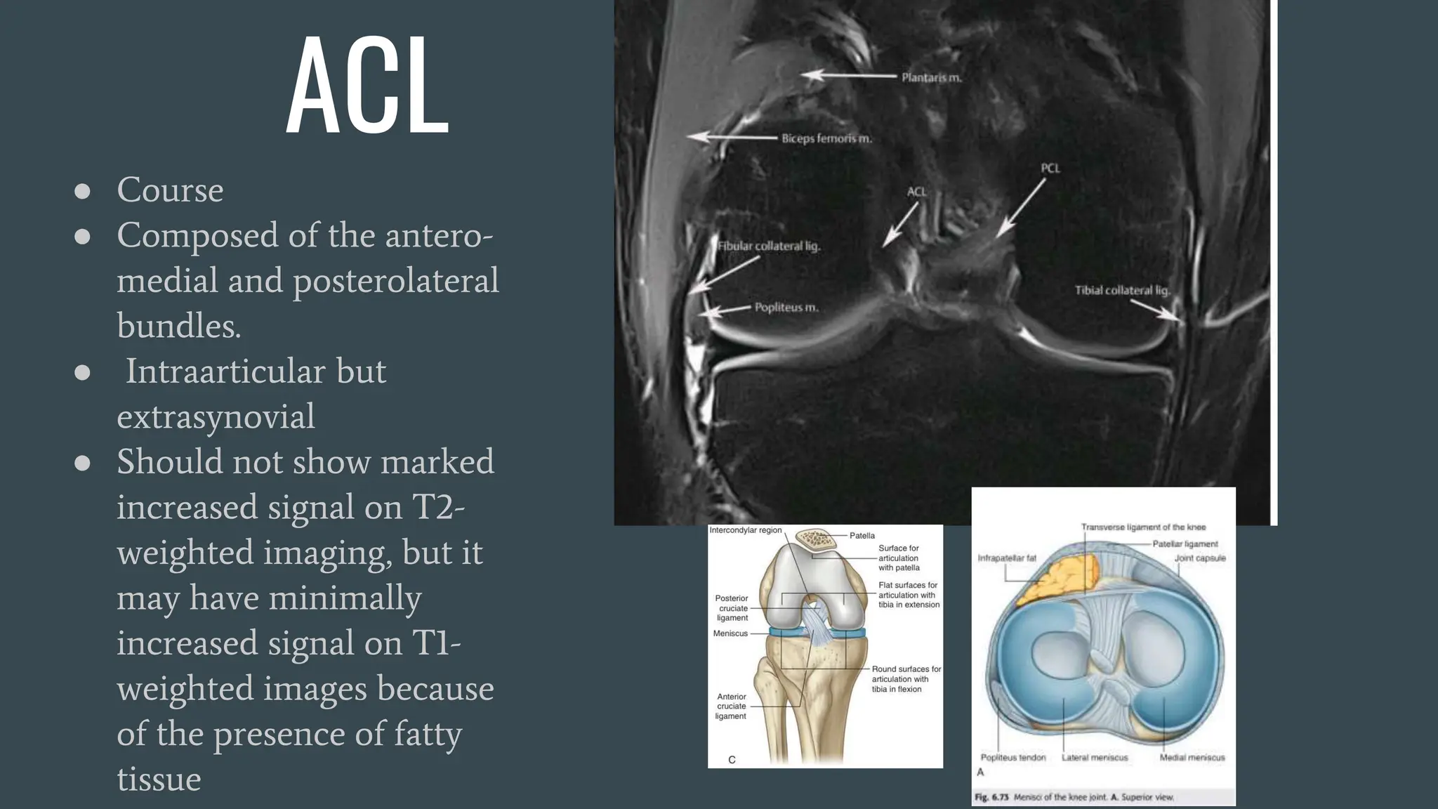 mri in orthopaedics its importance and understanding | PPTX