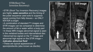mri in orthopaedics its importance and understanding | PPT
