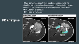 mri in orthopaedics its importance and understanding | PPT
