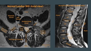 mri in orthopaedics its importance and understanding | PPT