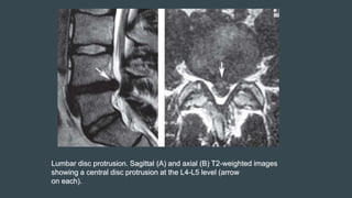 mri in orthopaedics its importance and understanding | PPT
