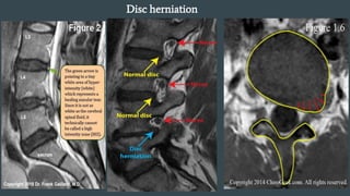 mri in orthopaedics its importance and understanding | PPT