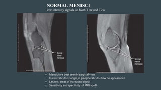 mri in orthopaedics its importance and understanding | PPT