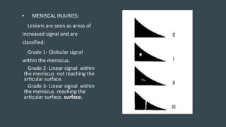 mri in orthopaedics its importance and understanding | PPT