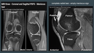 mri in orthopaedics its importance and understanding | PPT